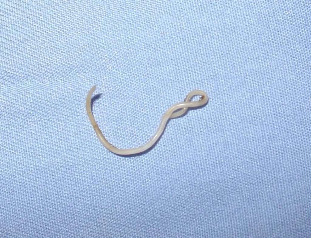 Nematodi, piccolissimi vermi cilindrici